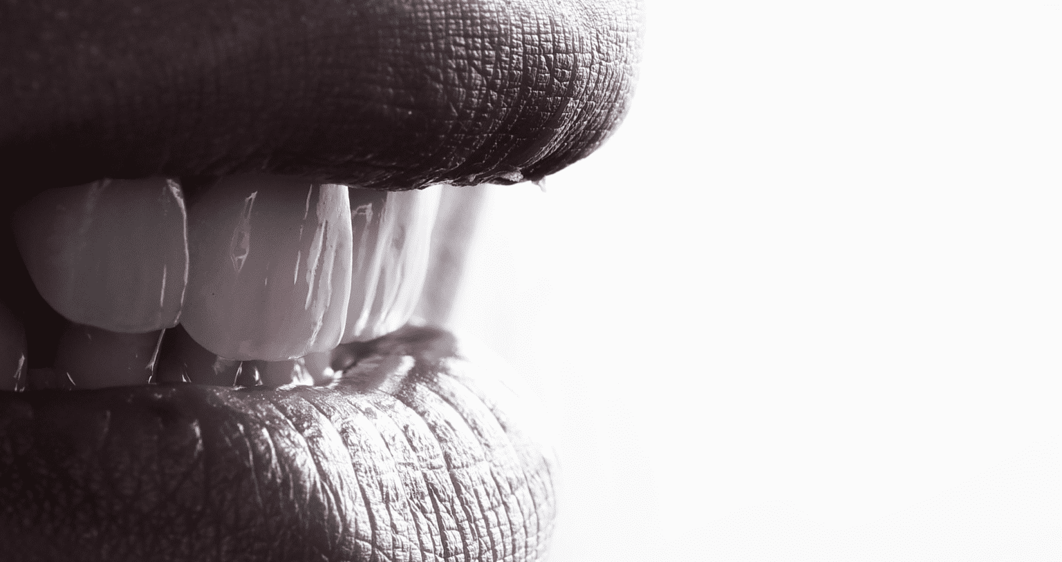 Aesthetic dentistry feldspathic veneers | DR ROZE BioDental Clinic