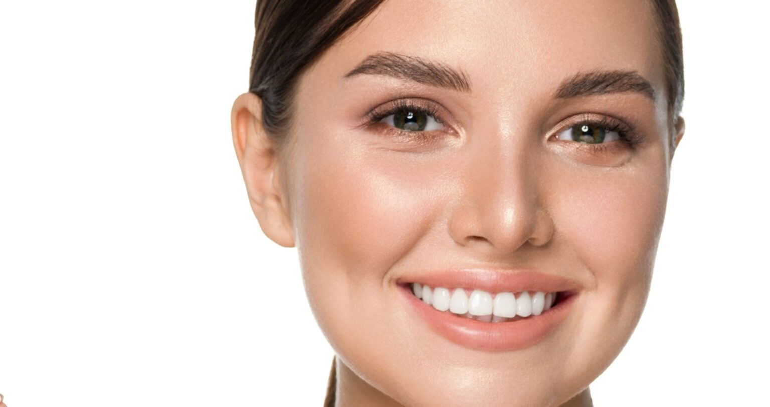 Feldspathic Veneers in Dubai - Dr Roze Biodental Clinic